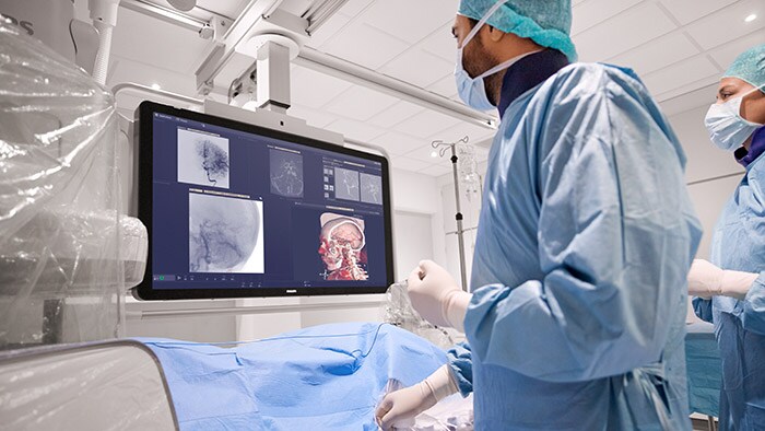 Azurion Biplane Image Guided Therapy System | Philips